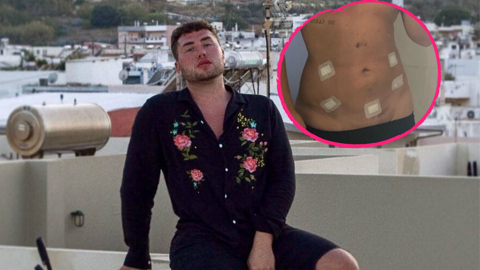 Nach Bodyshaming: "Prince Charming"-David beim Fettabsaugen