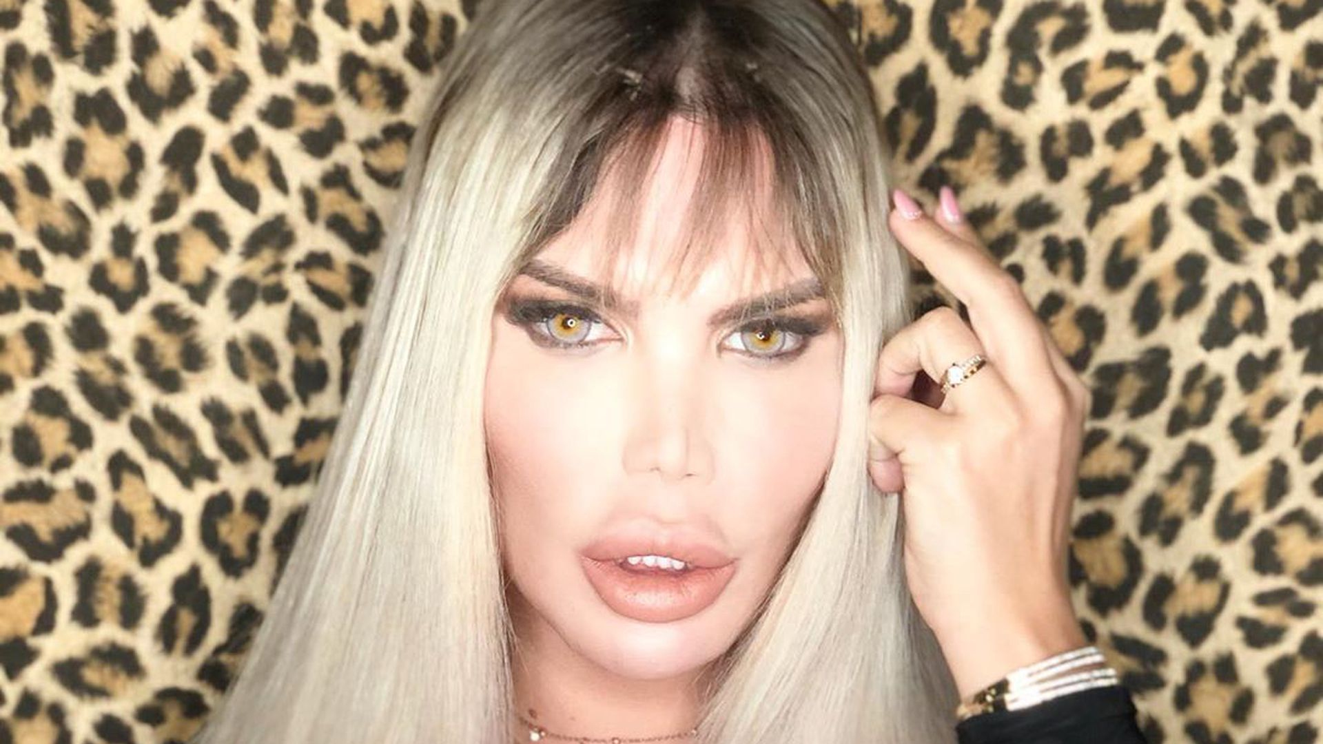 Rodrigo Alves möchte nach Geschlechtsumwandlung Kinder haben