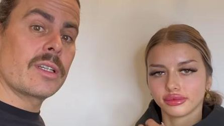 "Ex on the Beach"-Jenny gibt Ex Schuld an ihren Beauty-OPs